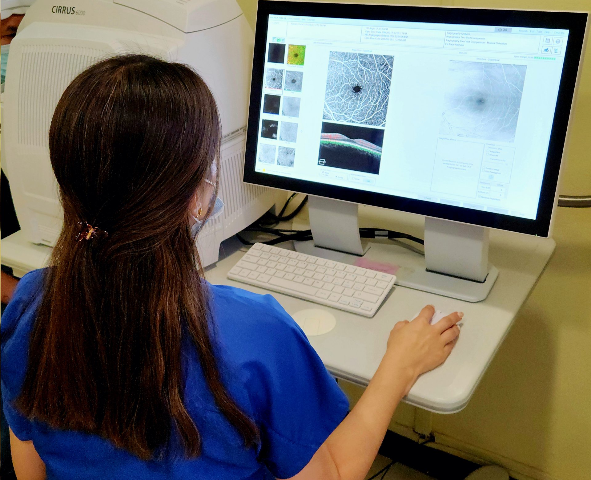 Tomografía de coherencia óptica (OCT) (Angio-OCT) y Fluorangiografía