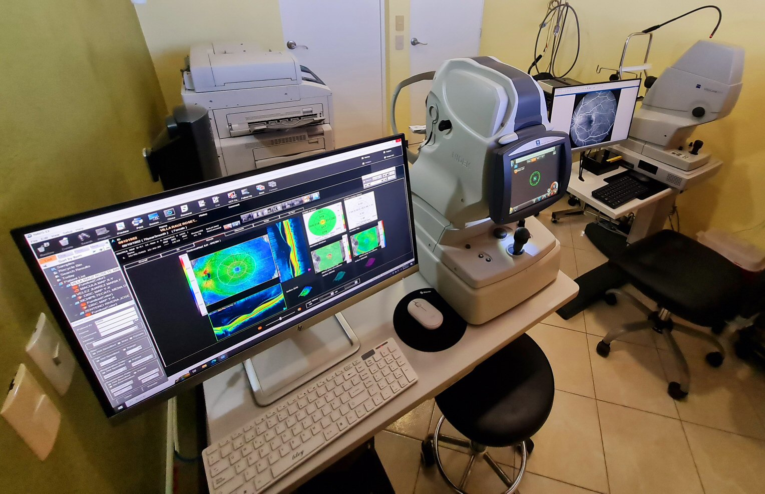 Tomografía de coherencia óptica (OCT) (Angio-OCT) y Fluorangiografía